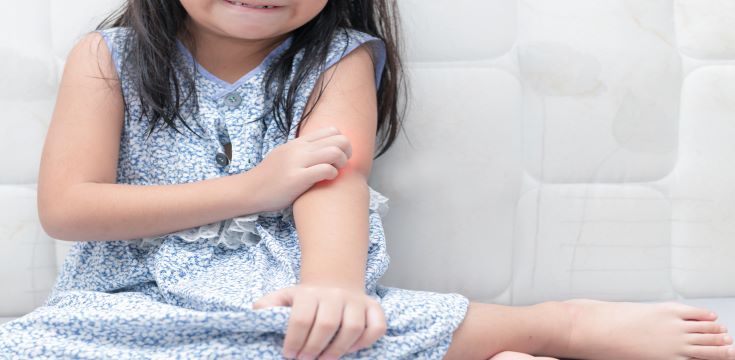Common Causes Of Skin Rashes In Children