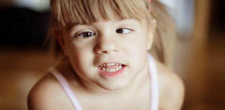 Squints In Children: Risk Factors, Causes & Treatments