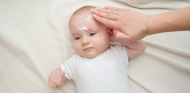 Helpful Tips for Managing Eczema in Babies